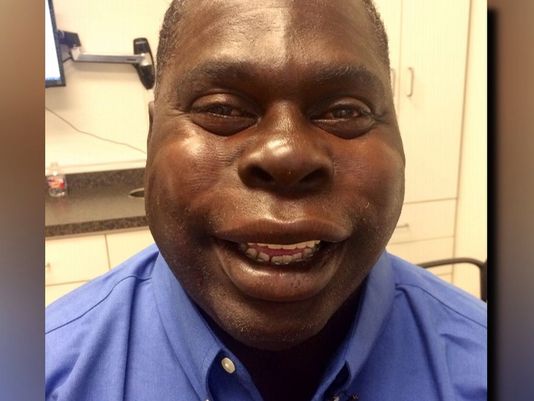Dentist gives once-homeless man a 'wonderful smile' | 13wmaz.com